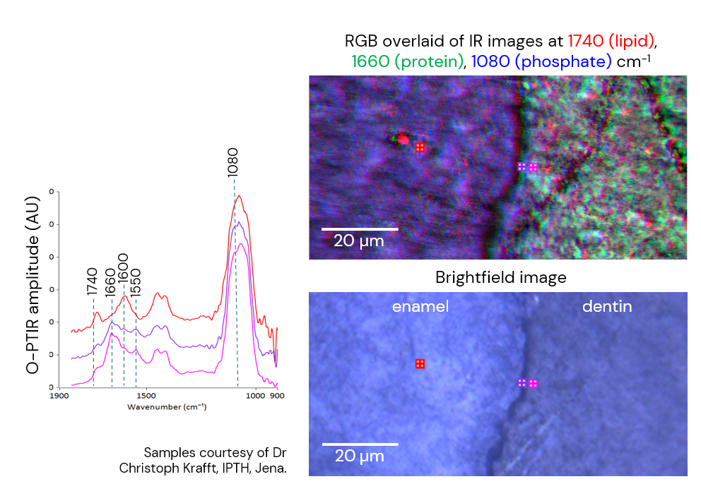 High resolution IR and Raman Imaging of hard tissue matter.